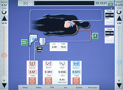 Terumo® Advanced Perfusion System 1 : Perfusion Products : Products ...